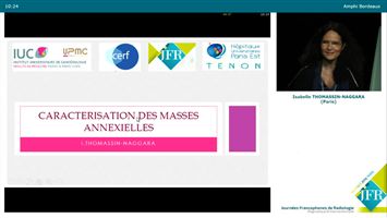 Masses annexielles | CERF - Collège des Enseignants en Radiologie de France