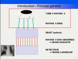 Fonctionnement d'un systeme d'imagerie utilisant les rayons X | CERF ...